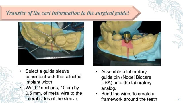 Surgical guide_ journal club | PPT