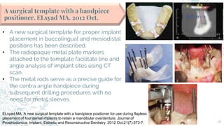 Surgical guide_ journal club | PPTX