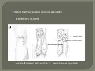 ortho journal club by Dr. Amit Motwani | PPTX