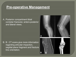 ortho journal club by Dr. Amit Motwani | PPTX