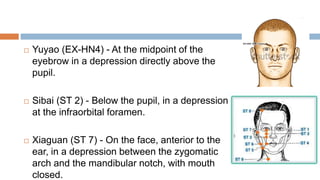 Journal Club Trigeminal Neuralgia | PPTX