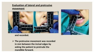 jounal club iprf to temporomandibular joint | PPT