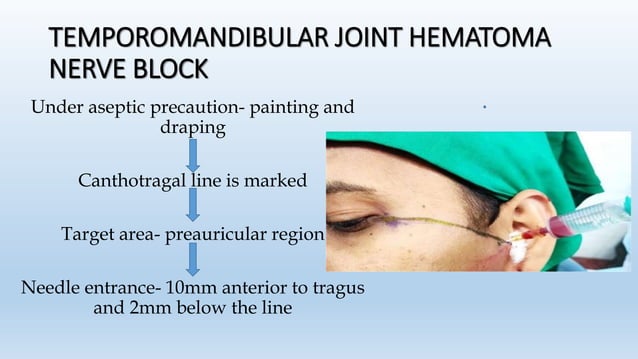 JC TRAUMA teju.pptx journal cluj temporomandibular joint | PPTX | Death, Injury, or Military ...