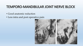JC TRAUMA teju.pptx journal cluj temporomandibular joint | PPTX