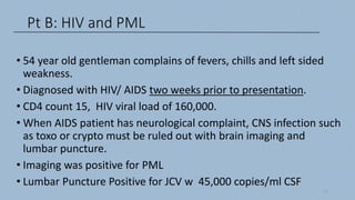 Pathology of JC Virus | PPTX