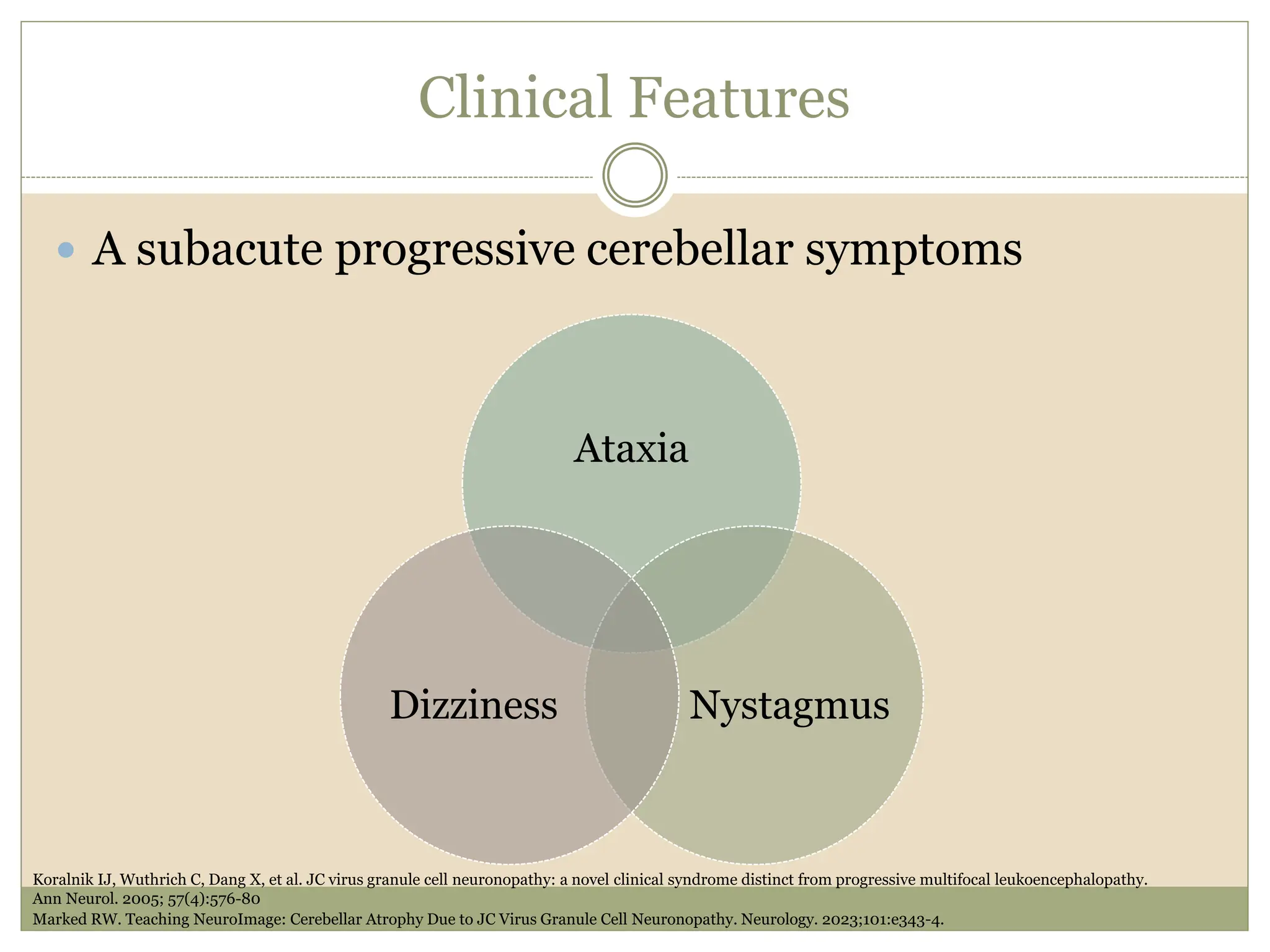 JC Virus Granule Cell Neuronopathy.pptx . | PPTX