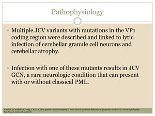 JC Virus Granule Cell Neuronopathy.pptx . | PPTX