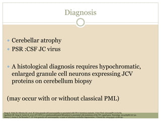 JC Virus Granule Cell Neuronopathy.pptx . | PPTX