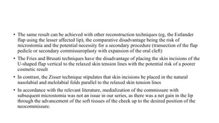 JC ZISSER FLAP.pptx oral and maxillofacial surgery | PPTX