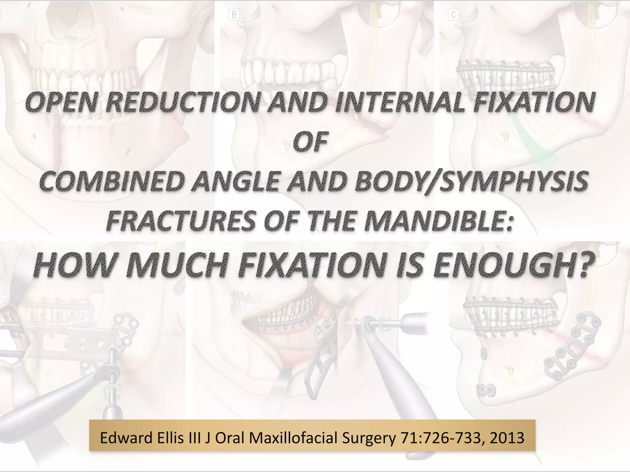 OPEN REDUCTION AND INTERNAL FIXATION OF COMBINED ANGLE AND BODY ...