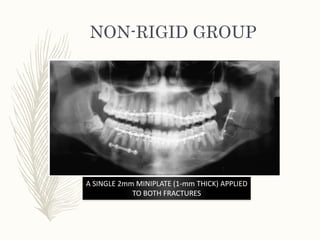 OPEN REDUCTION AND INTERNAL FIXATION OF COMBINED ANGLE AND BODY ...