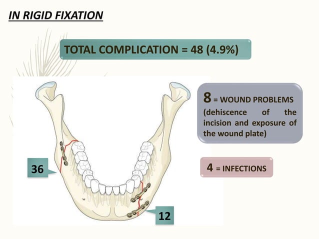 OPEN REDUCTION AND INTERNAL FIXATION OF COMBINED ANGLE AND BODY ...