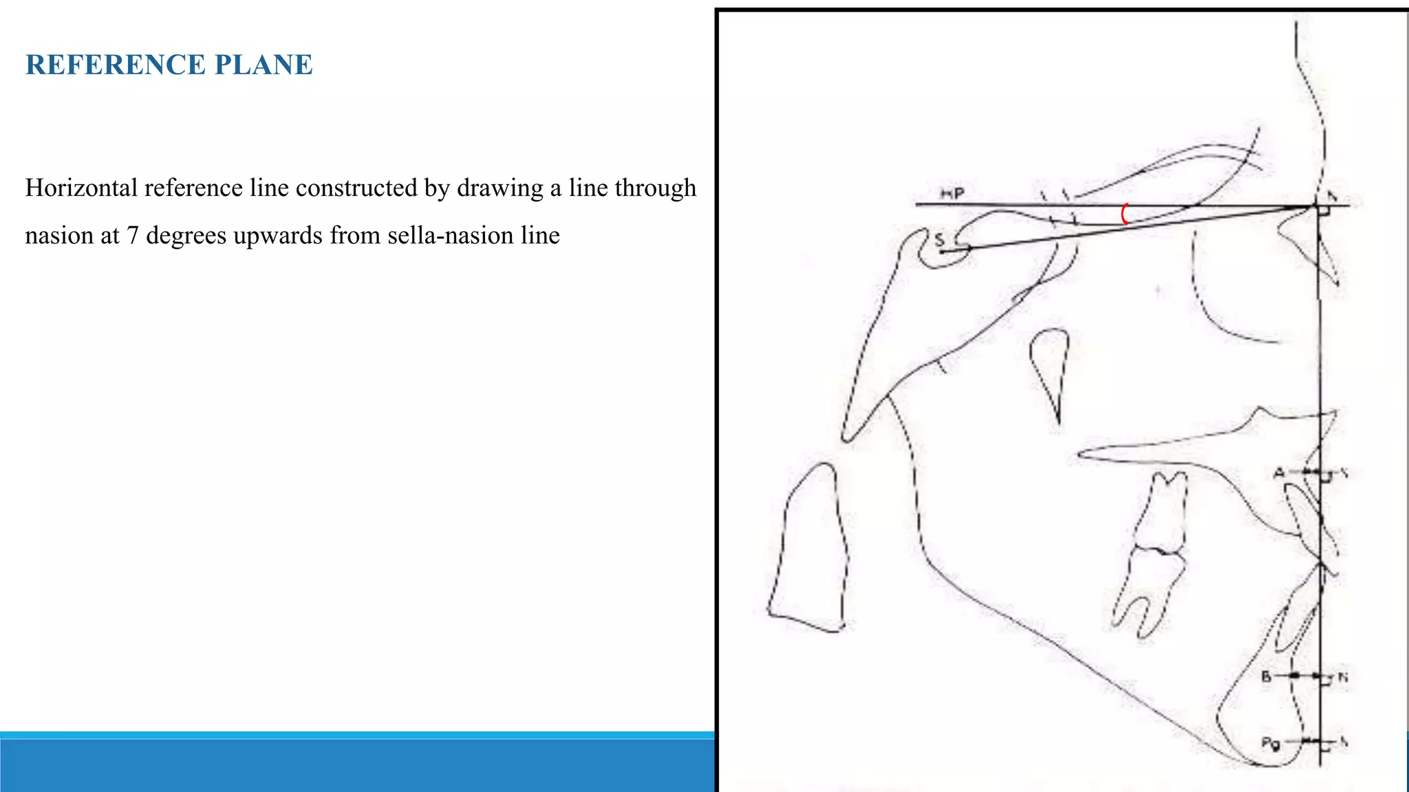 COGS Burstone analysis for orthognathic surgery | PPTX