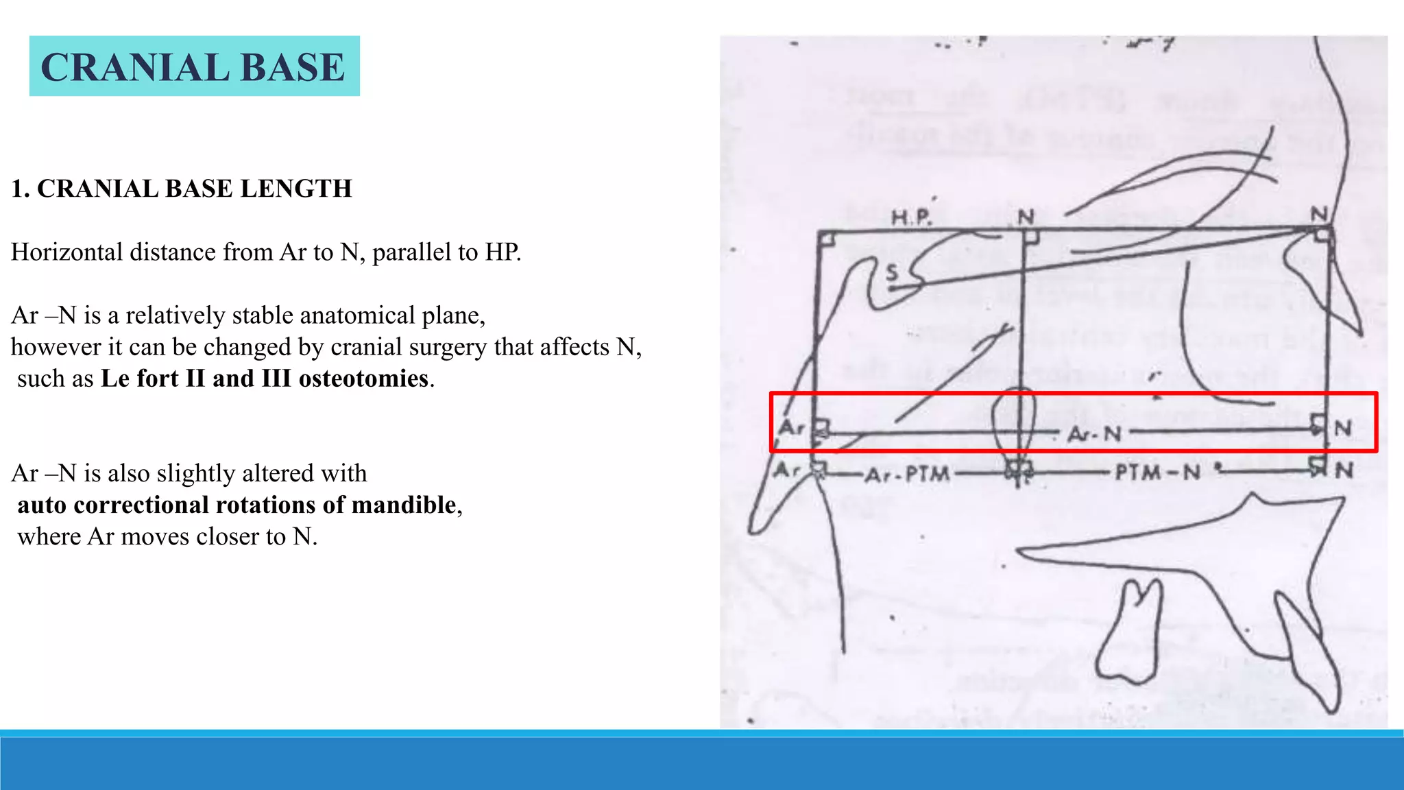 COGS Burstone analysis for orthognathic surgery | PPTX