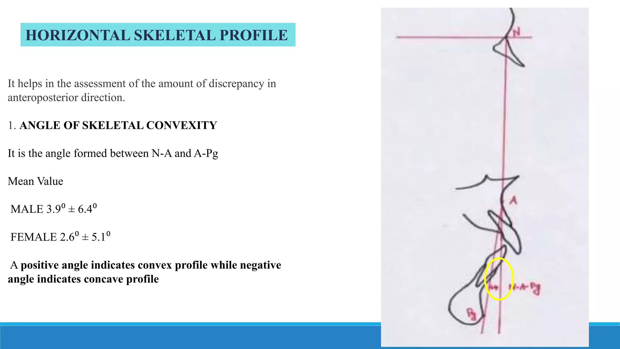 COGS Burstone analysis for orthognathic surgery | PPTX