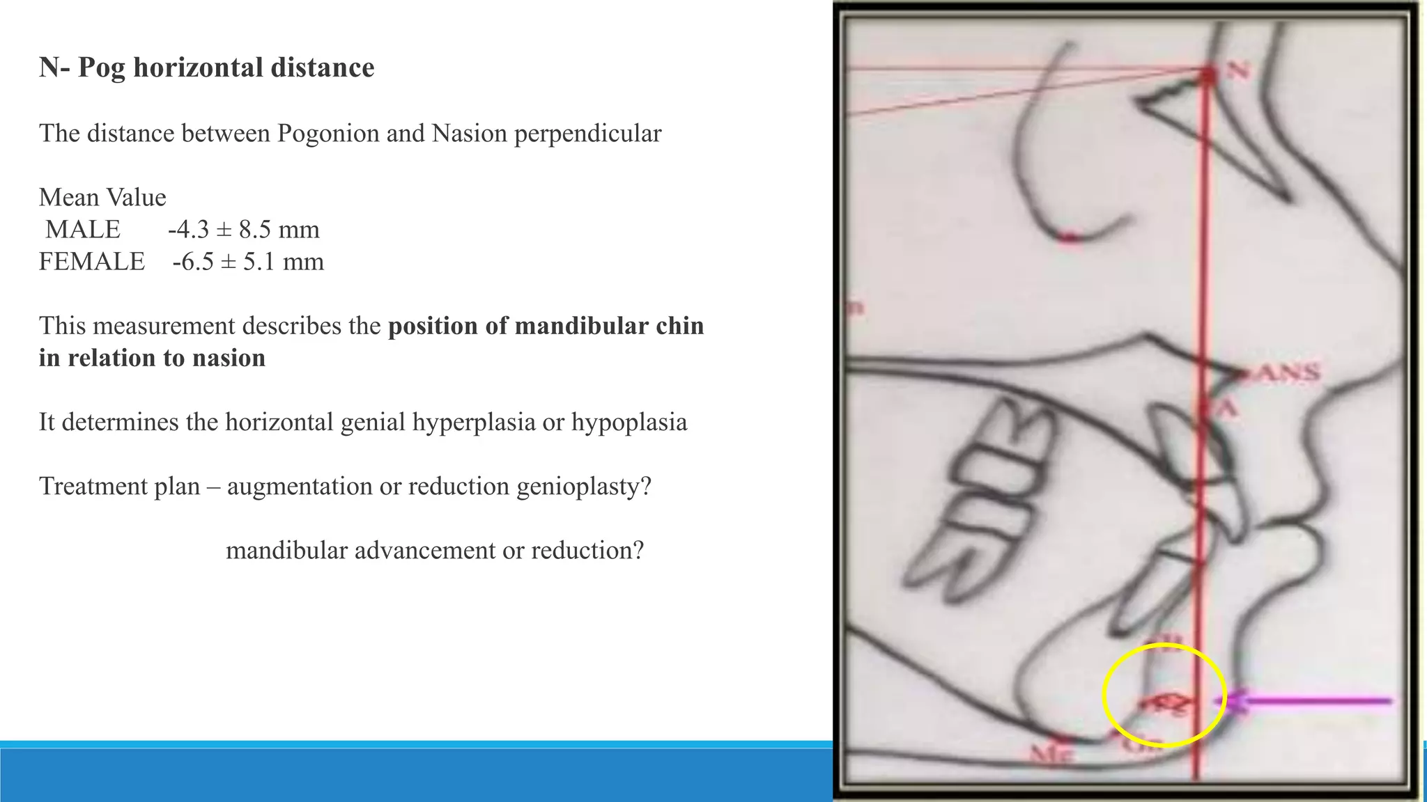 COGS Burstone analysis for orthognathic surgery | PPTX