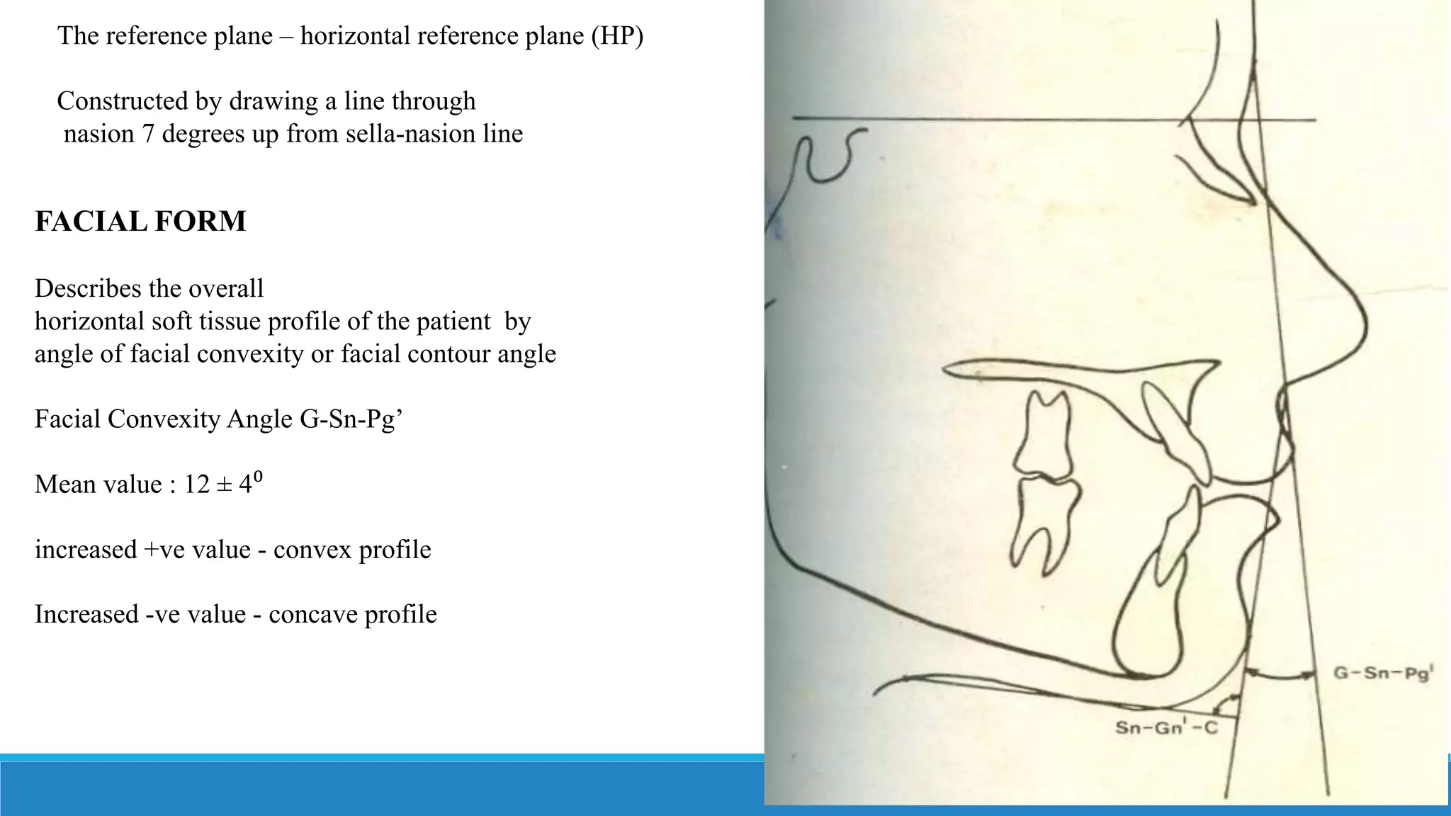 COGS Burstone analysis for orthognathic surgery | PPTX
