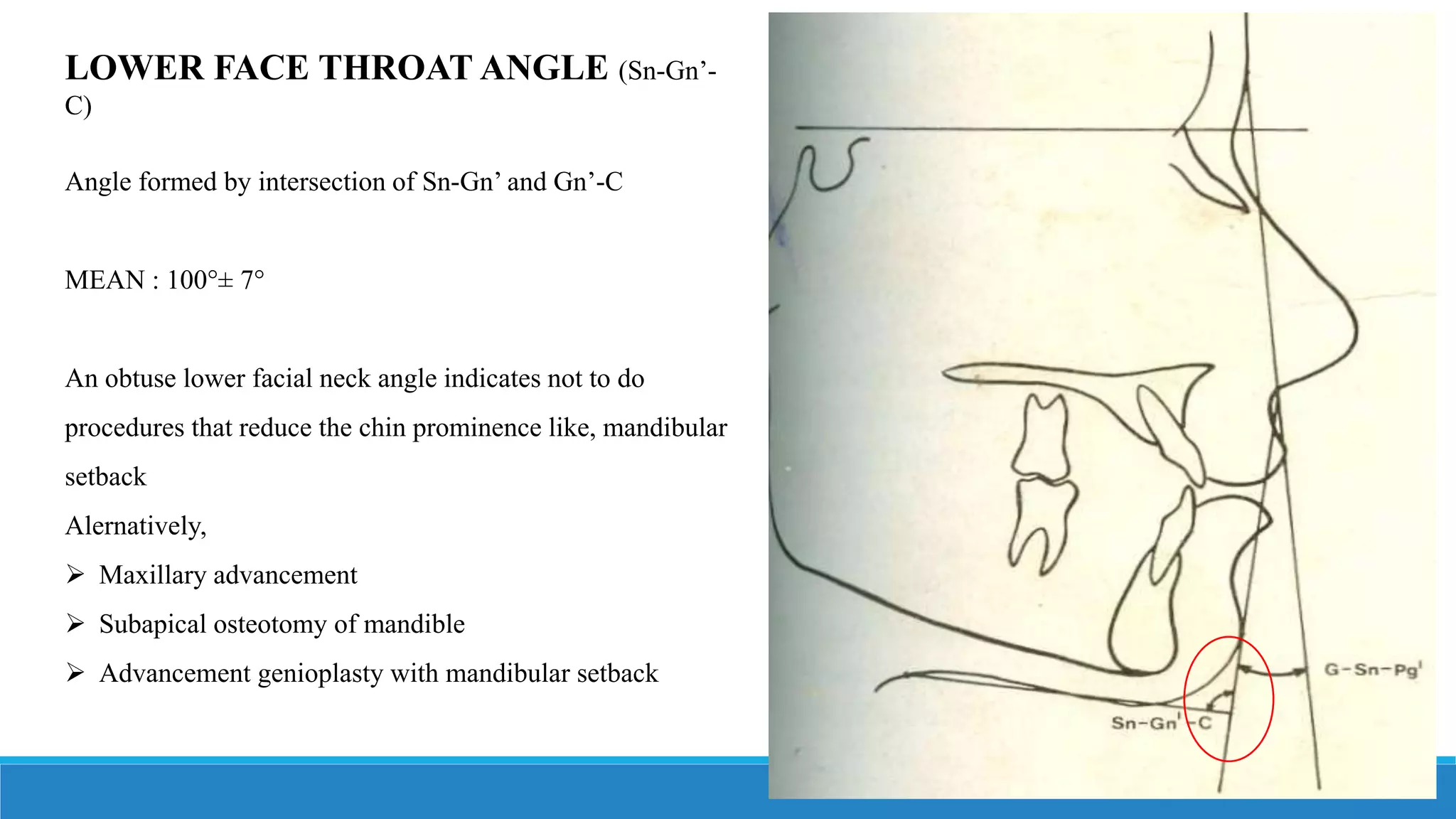 COGS Burstone analysis for orthognathic surgery | PPTX