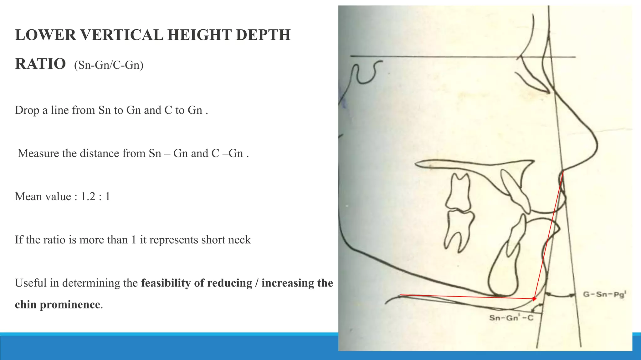 COGS Burstone analysis for orthognathic surgery | PPTX