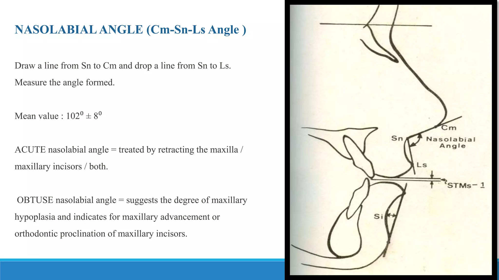 COGS Burstone analysis for orthognathic surgery | PPTX
