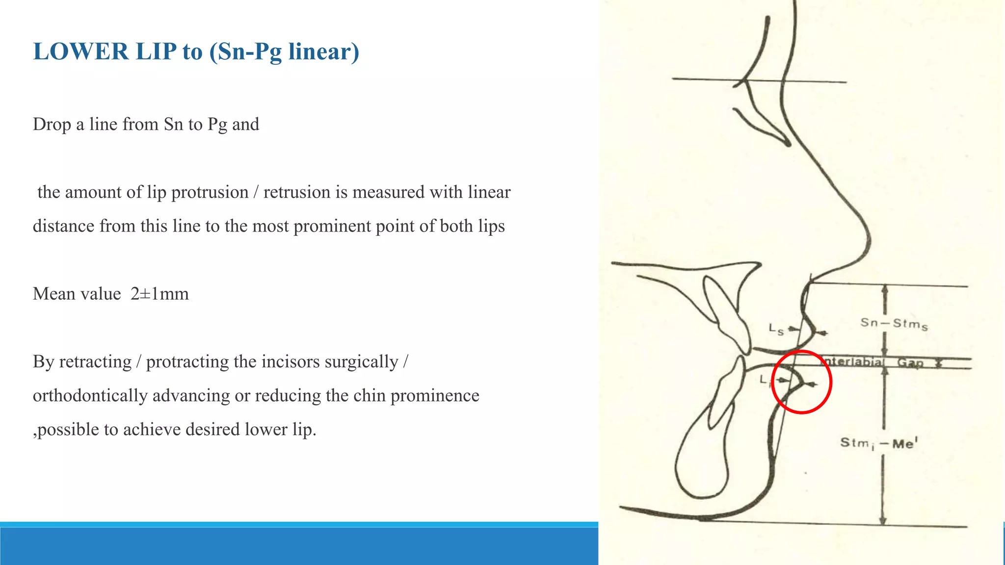 COGS Burstone analysis for orthognathic surgery | PPTX