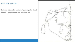 COGS Burstone analysis for orthognathic surgery | PPTX