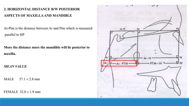 COGS Burstone analysis for orthognathic surgery | PPTX