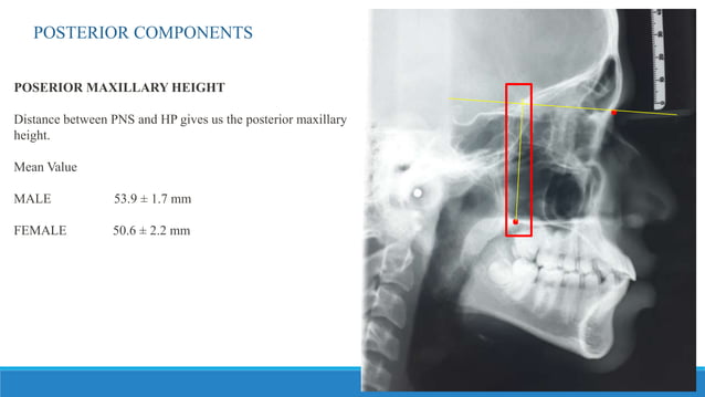 COGS Burstone analysis for orthognathic surgery | PPTX