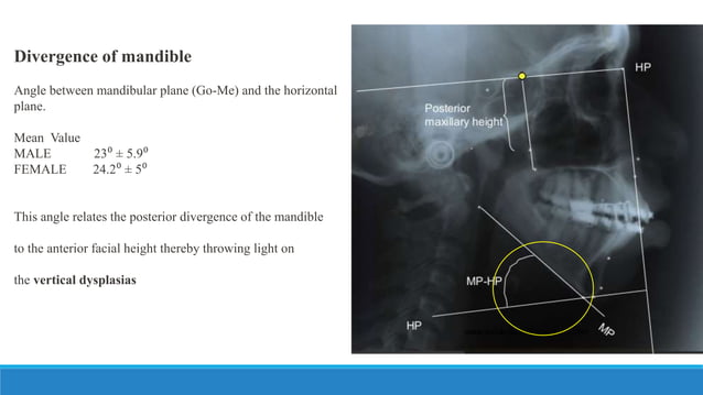 COGS Burstone analysis for orthognathic surgery | PPTX