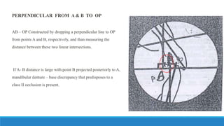 COGS Burstone analysis for orthognathic surgery | PPTX