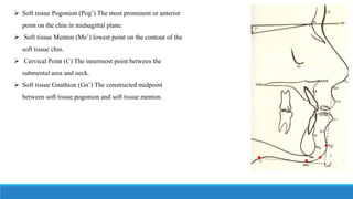 COGS Burstone analysis for orthognathic surgery | PPTX