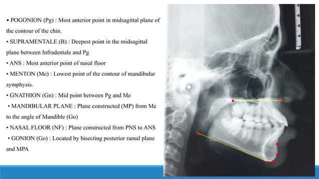 COGS Burstone analysis for orthognathic surgery | PPTX