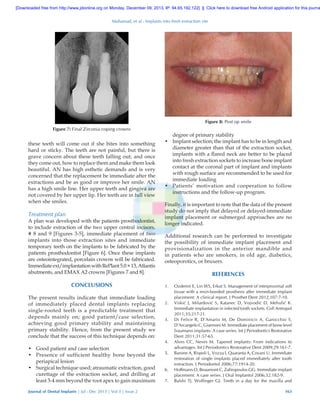 Implants into fresh extraction site: A literature review, case immediate placement report | PDF
