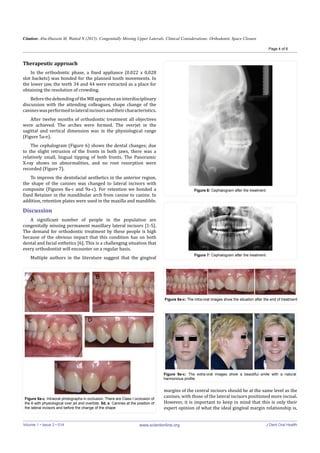 Congenitally Missing Upper Laterals. Clinical Considerations ...