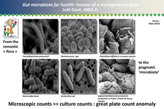 Gut microbiota for health: lessons of a metagenomic scan (by Joel Doré ...
