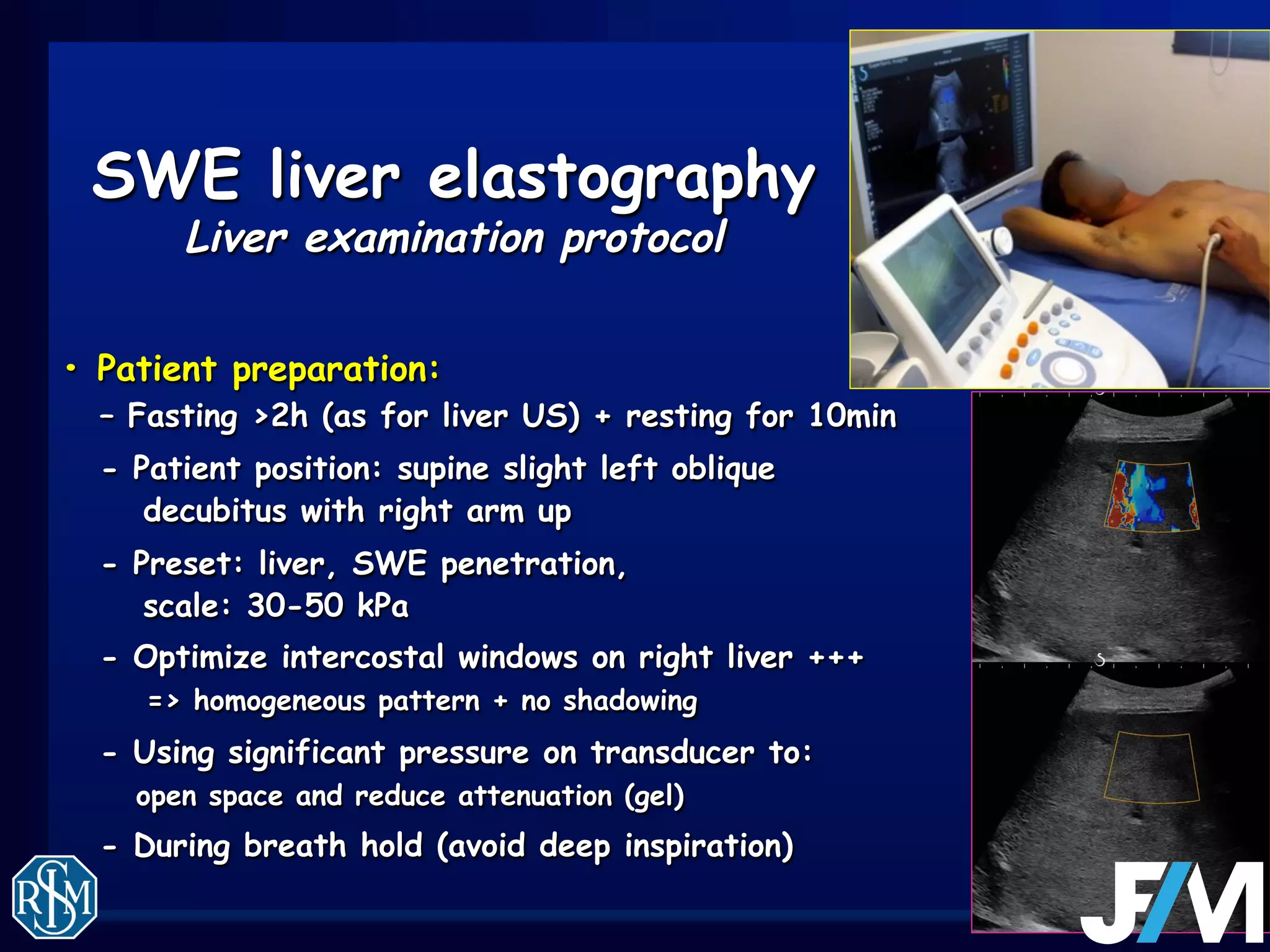 Jean Michel Correas, place and role of shear wave elastography for ...