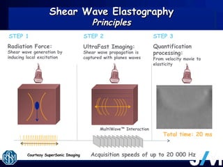 Jean Michel Correas, place and role of shear wave elastography for ...