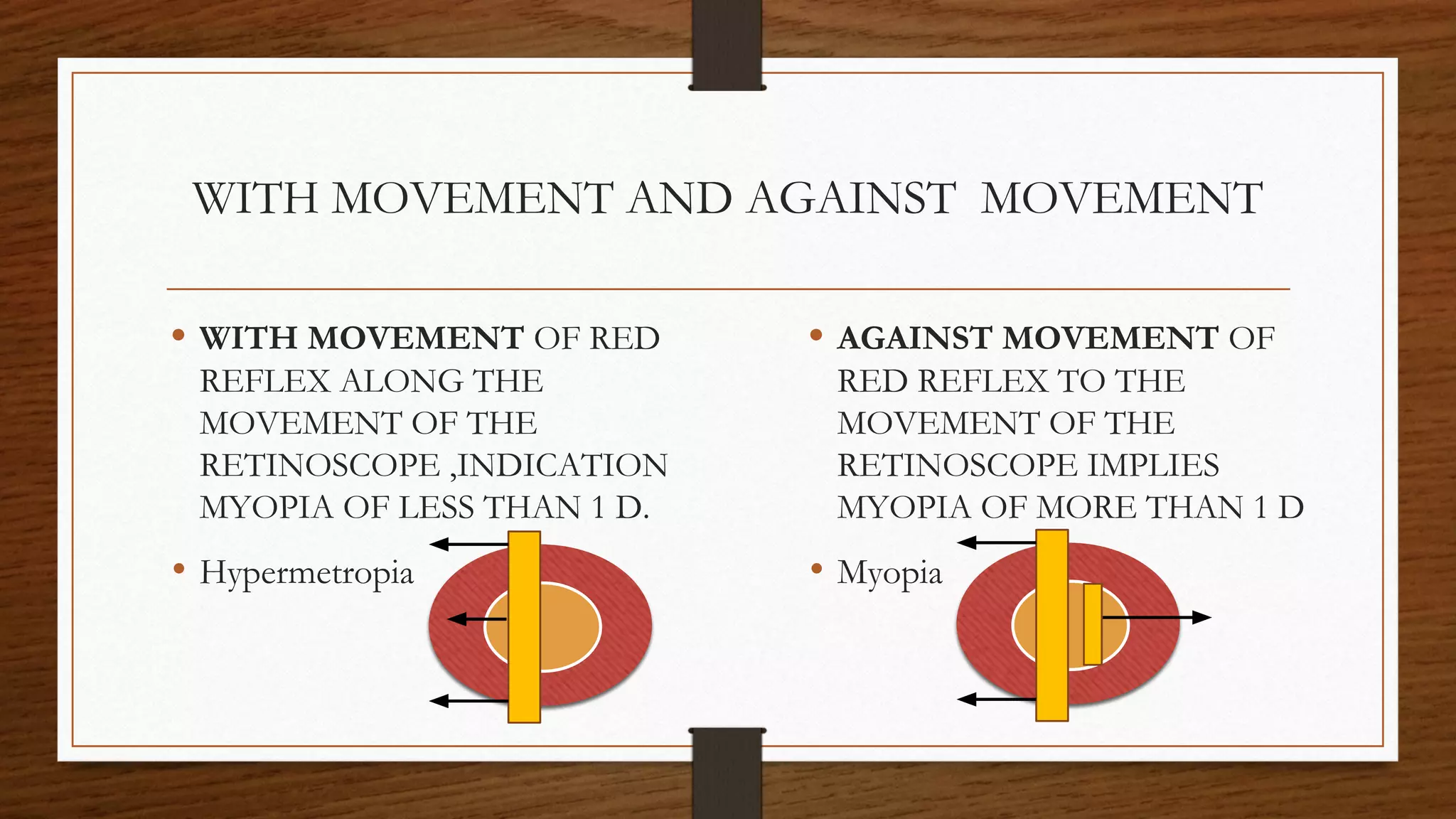 Ratinoscopy procedure.pptx