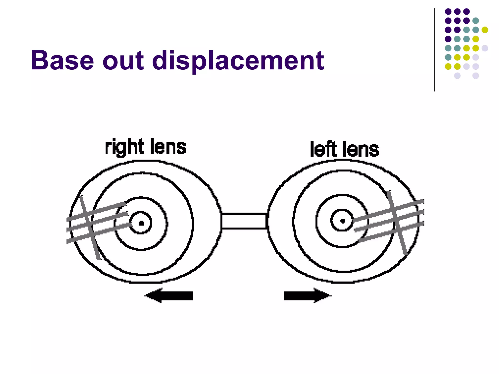 Ophthalmic Prisms: Prismatic Effects and Decentration | PPT