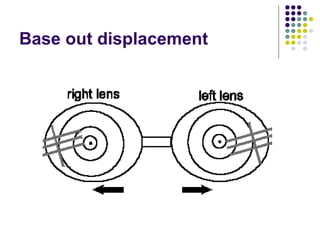Ophthalmic Prisms: Prismatic Effects and Decentration | PPT