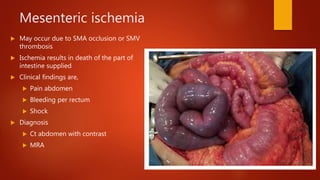 Gross Anatomy Of Jejunum and ileum | PPTX