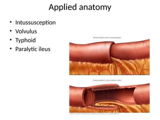 Jejunum and Ileum.pptx.................... | PPTX | Medical Health