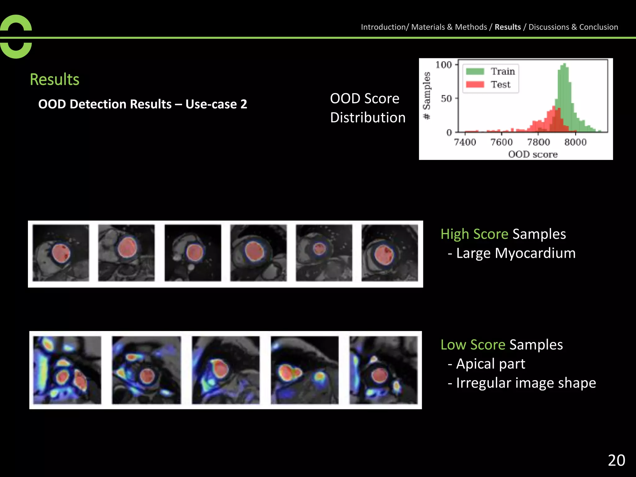 Energy Based Model For Out Of Distribution Detection In Deep Medical Image Segmentation Ppt