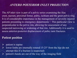 X-RAY PELVIS PROJECTIONS | PPTX