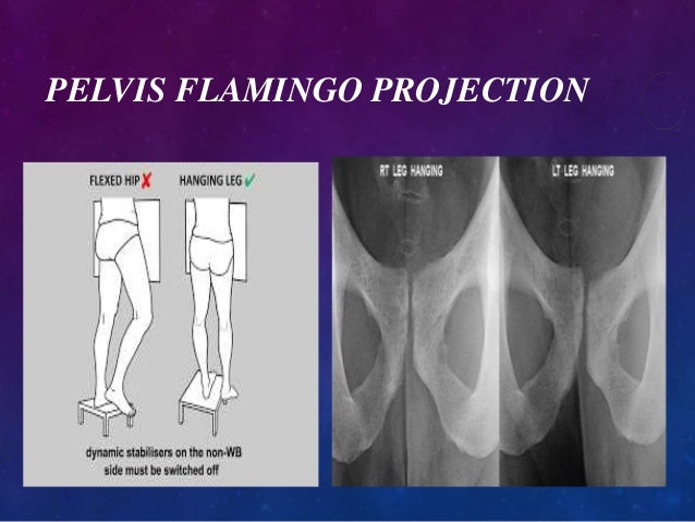 X-RAY PELVIS PROJECTIONS