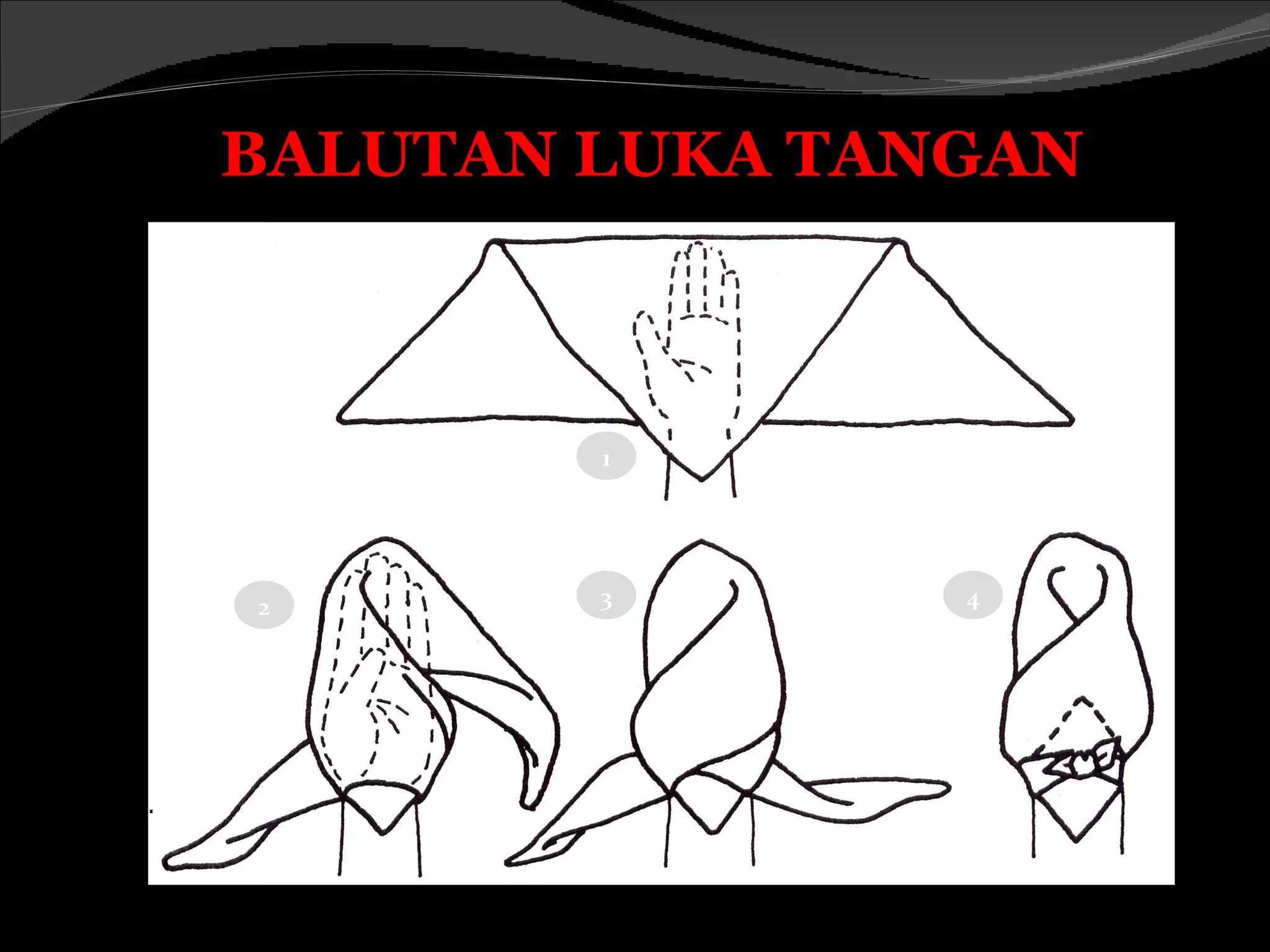 Jenis jenis balutan luka | PPT