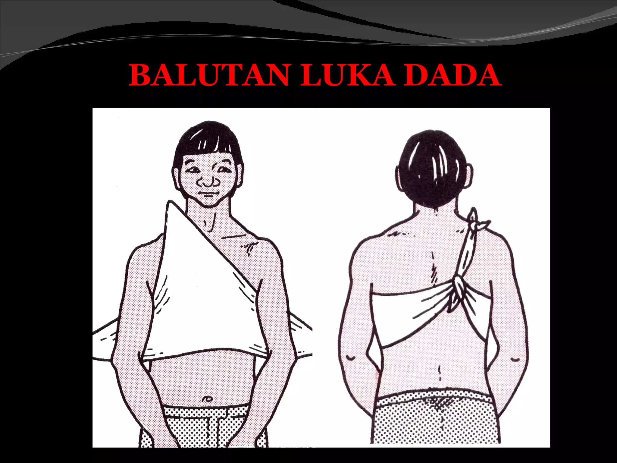 Jenis jenis balutan luka | PPT