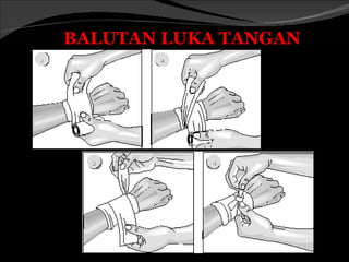 Jenis jenis balutan luka | PPT