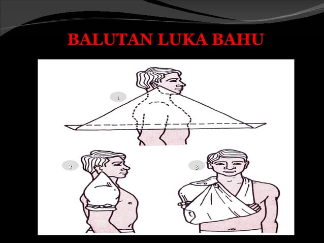 Jenis jenis balutan luka | PPT
