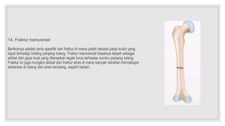 Type of Fracture MSK Radiology- Redo.pptx